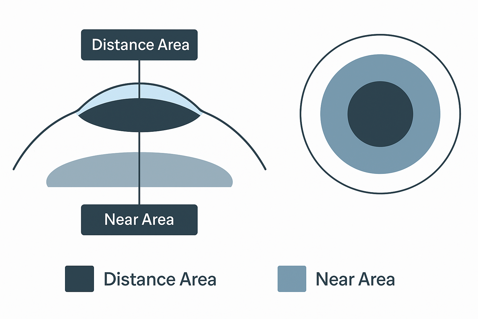 PresbyMAX® | Laser Treatment for Presbyopia